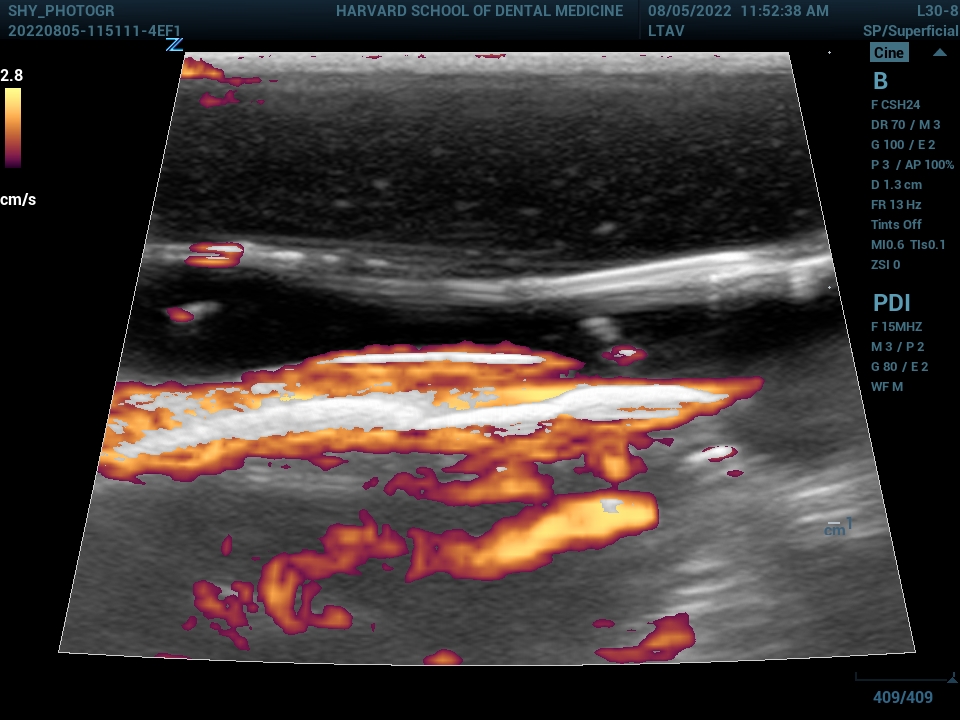 Advances in Dental Ultrasonography | Harvard School of Dental Medicine